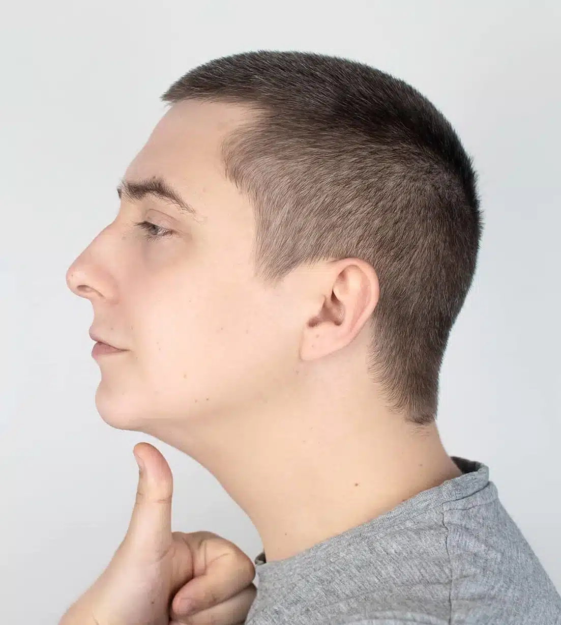 Chin Augmentation in Irvine, CA | SoCal Aesthetic Surgery